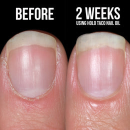 Holo Taco | Nail Oil Pen | Nail Care